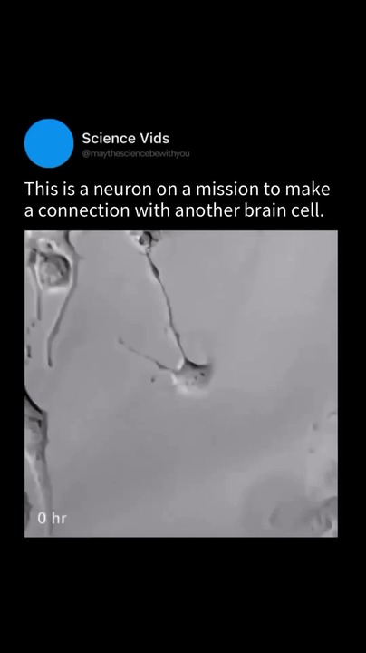 That other neuron shouting 'I'm here'! - Meme by Wr3m3M3m3d :) Memedroid