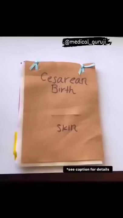 Cesarian birth layers - Meme by ri3zo :) Memedroid
