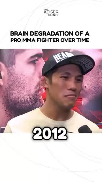 Brain injury in MMA fighters - Meme subido por Skaint :) Memedroid